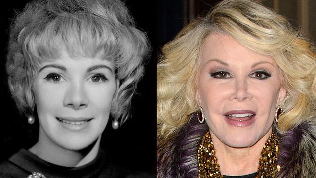 7 Wajah Artis Hollywood Mengerikan Setelah Operasi Plastik - ShowBiz ...