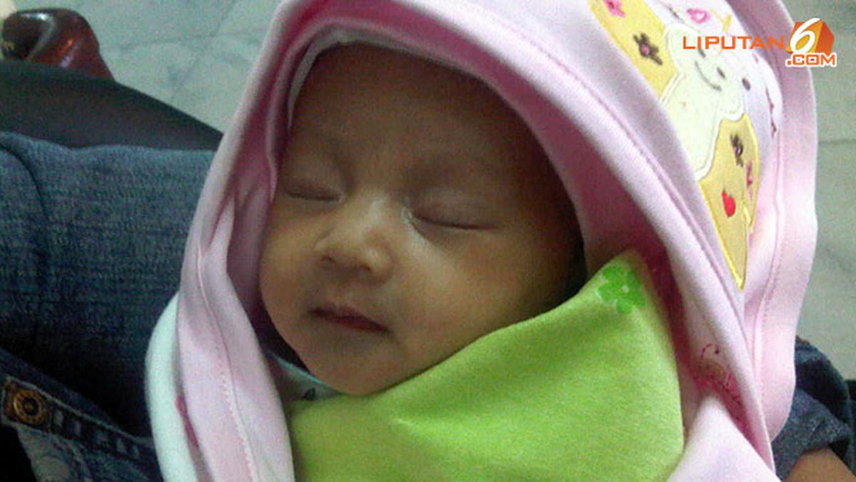 Bayi yang Lahir dengan Usus Terburai Sudah Normal dan Sehat - Health ...