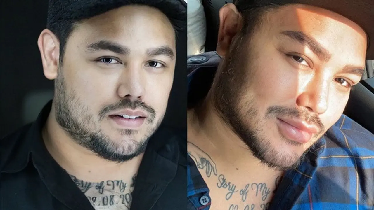 6 Potret Ivan Gunawan Usai Filler Bibir, Makin Cetar - Hot Liputan6.com