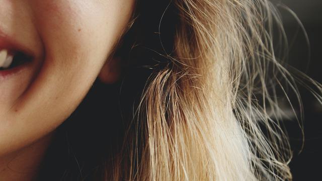 Apa itu Apple Cheeks? Berikut Penjelasannya - Beauty Fimela.com