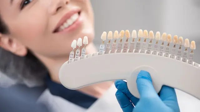 Jenis-Jenis Veneer Gigi, Kisaran Harga dan Efek Samping yang Perlu ...