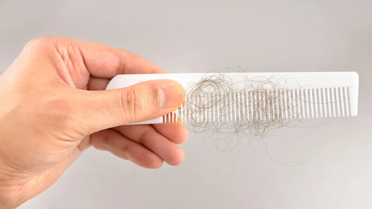 Rambut Rontok Pada Pria, Ini Penyebab dan Cara Mengatasinya yang Tepat