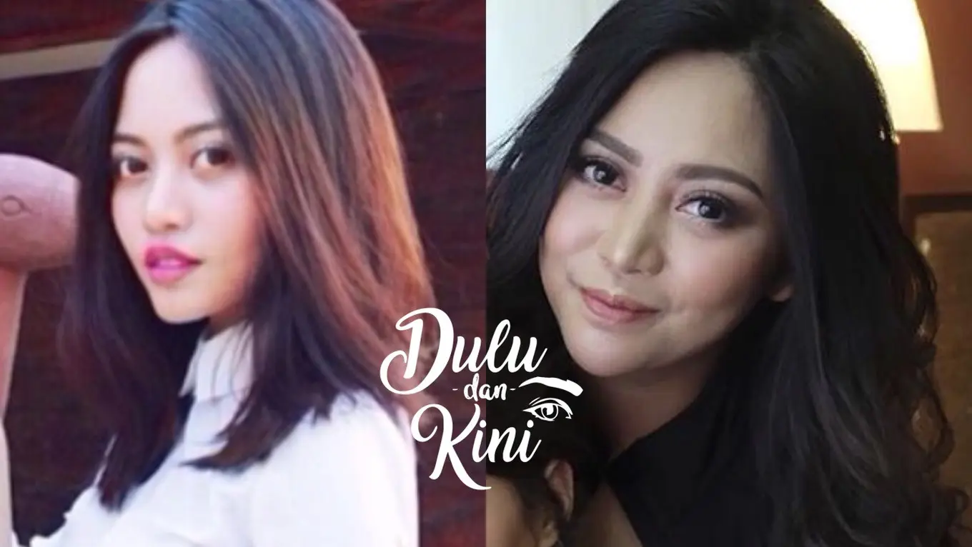 Dulu dan Kini: Transformasi Rachel Vennya dari Tampilan Aneh Hingga ...