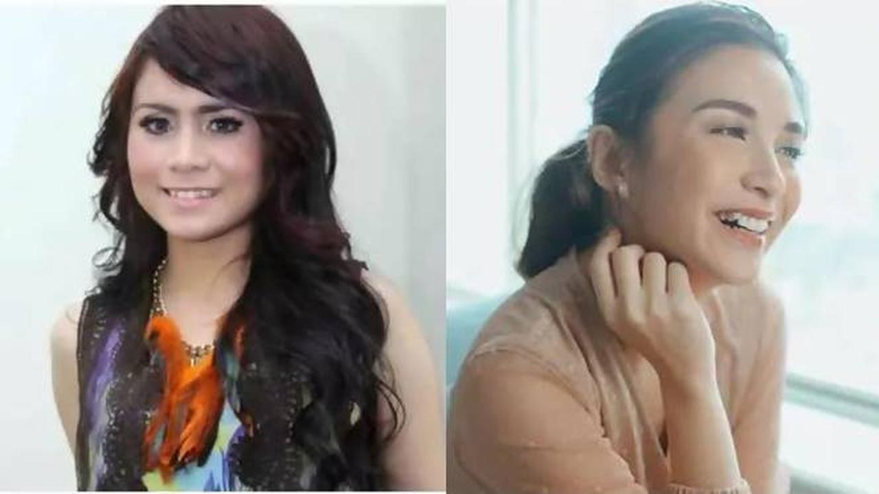 Potret 6 Artis Sebelum dan Sesudah Hilangkan Gigi Gingsul, Tuai Perdebatan
