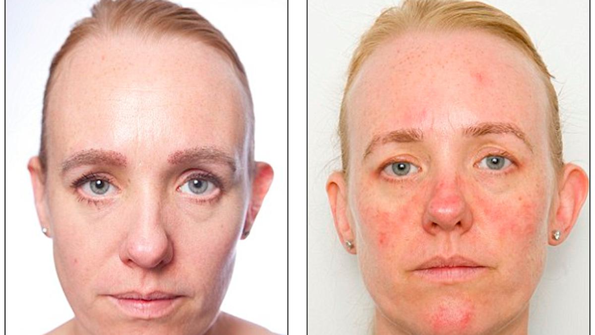 Begini Penampakan Wajah yang Sering Tak Dibersihkan Jelang Tidur ...