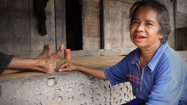 Benarkah Tradisi Nyirih Bisa Bikin Kanker Mulut? - Health Liputan6.com