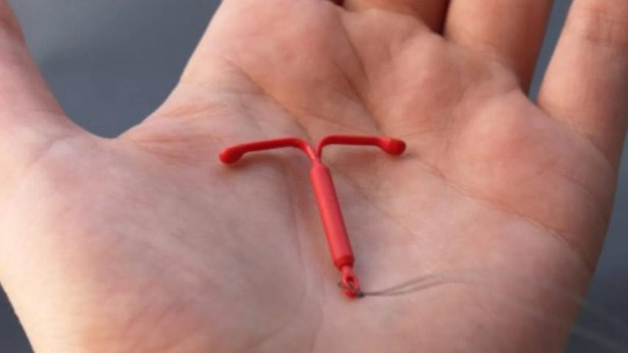 Cara Pemasangan KB IUD dan Fakta Penting yang Wajib Diketahui Pasien