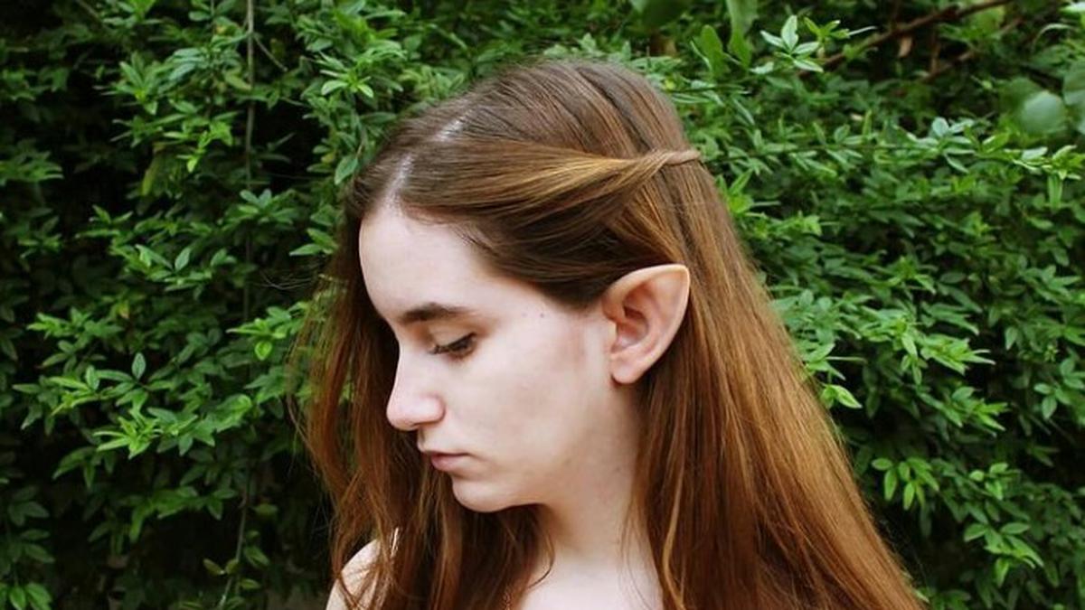 Telinga Peri, Tren Operasi Plastik yang Digemari Anak Muda China