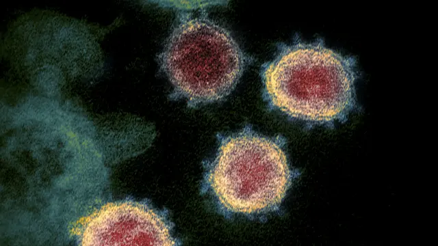 Mengenal 13 Jenis Virus dan Durasi Penemuan Vaksinnya - Health Liputan6.com