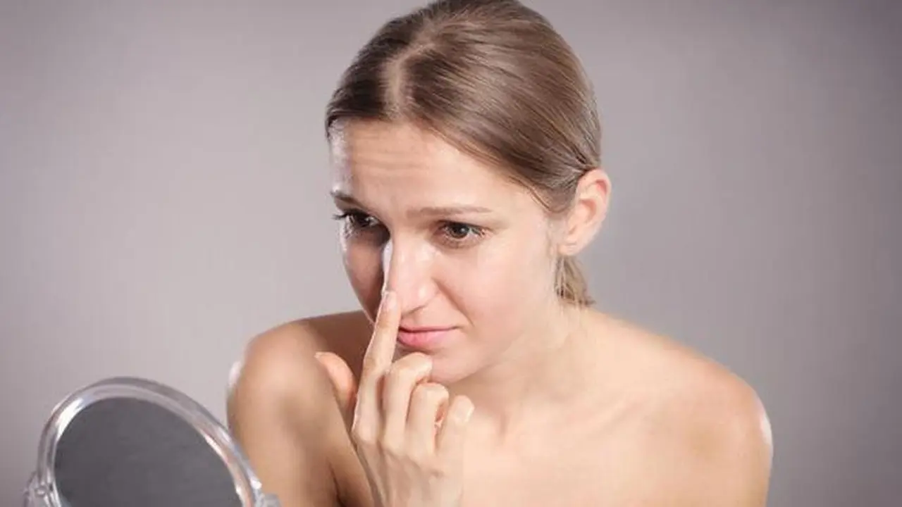 Perbedaan Komedo Putih dan Hitam, Ketahui Penyebab dan Cara ...