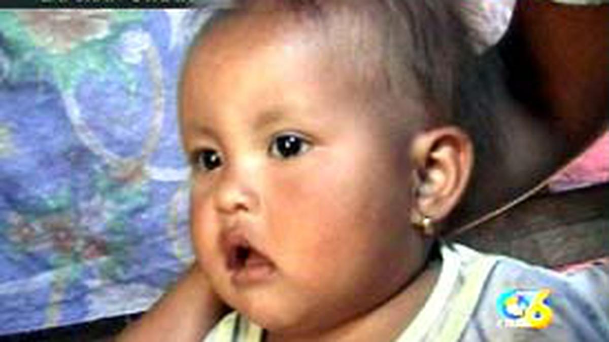 Pasien Busung Lapar di Manggarai Membaik - News Liputan6.com