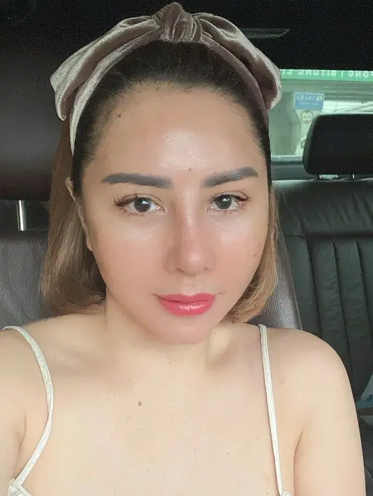 Transformasi Femmy Permatasari dari Dulu hingga Baru Selesai Operasi Plastik di Korea - Foto ...