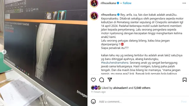 Teuku Rifnu Wikana Geram Anak-anak dan Keponakannya Kecelakaan Ditabrak oleh Pengendara Sepeda ...