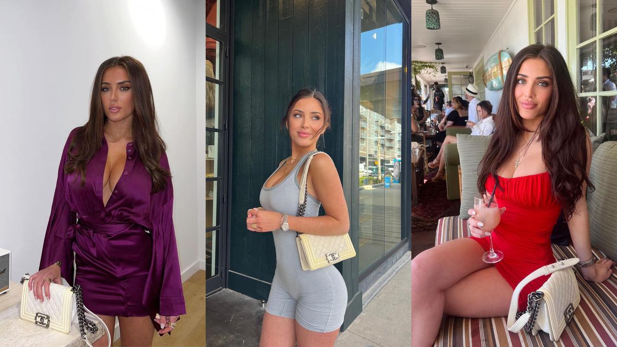 Sosok Sumner Stroh, Model Cantik yang Mengaku Jadi Selingkuhan Adam ...