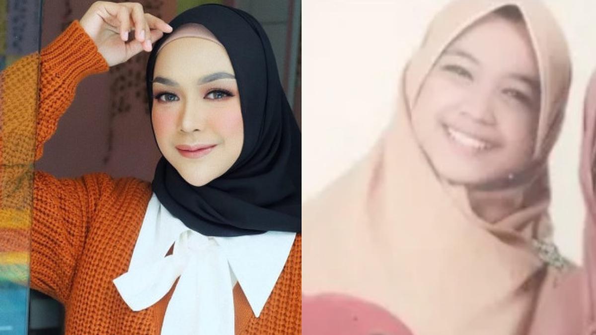 Dituding Operasi Plastik, Ini 7 Potret Transformasi Ria Ricis