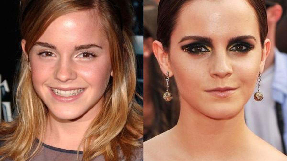 Selebritis yang Mengubah Gaya Rambutnya Secara Drastis - Photo Fimela.com