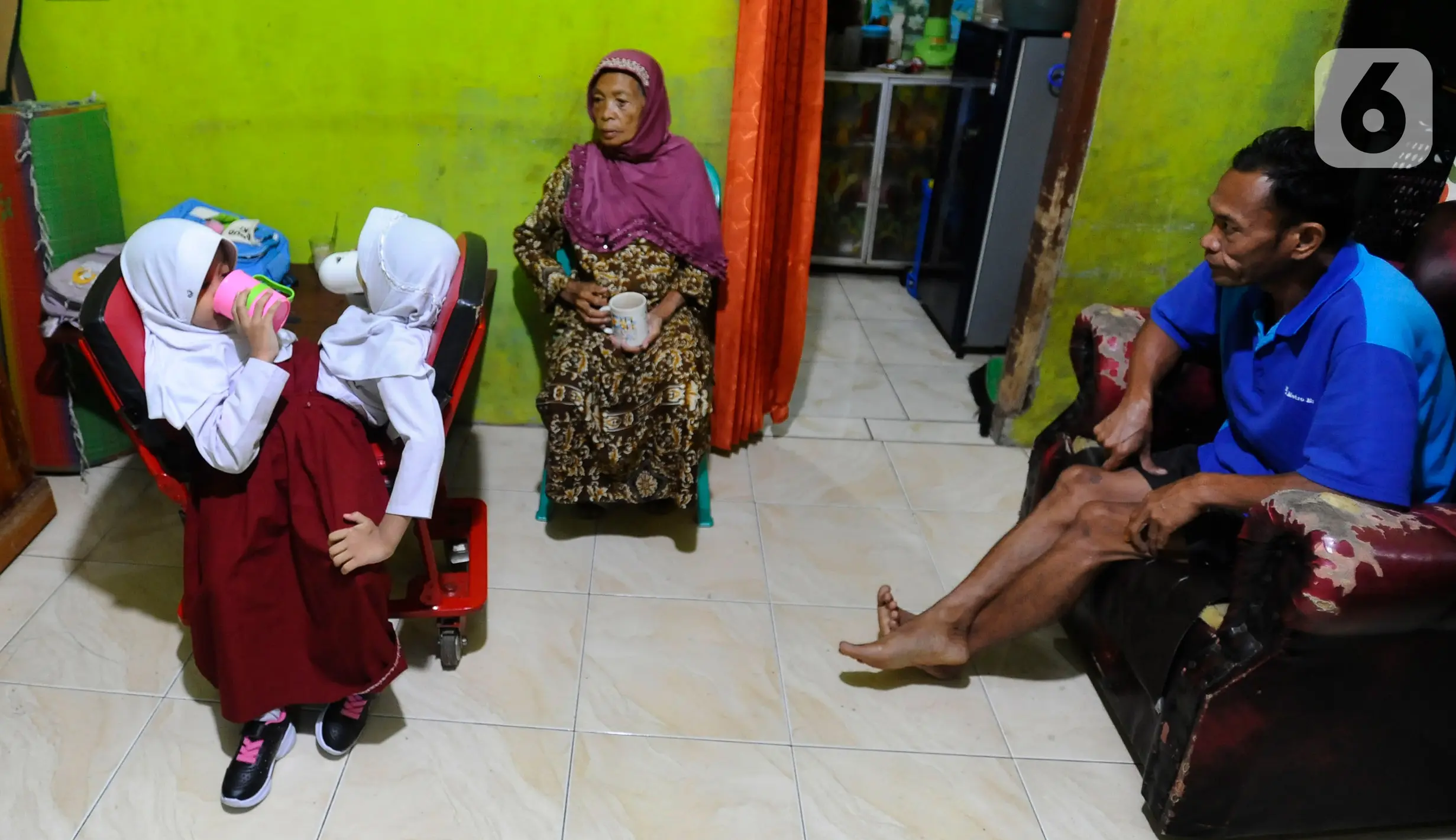 Potret Semangat Kembar Siam Al Dewi dan Al Putri Asal Garut - Foto Liputan6.com