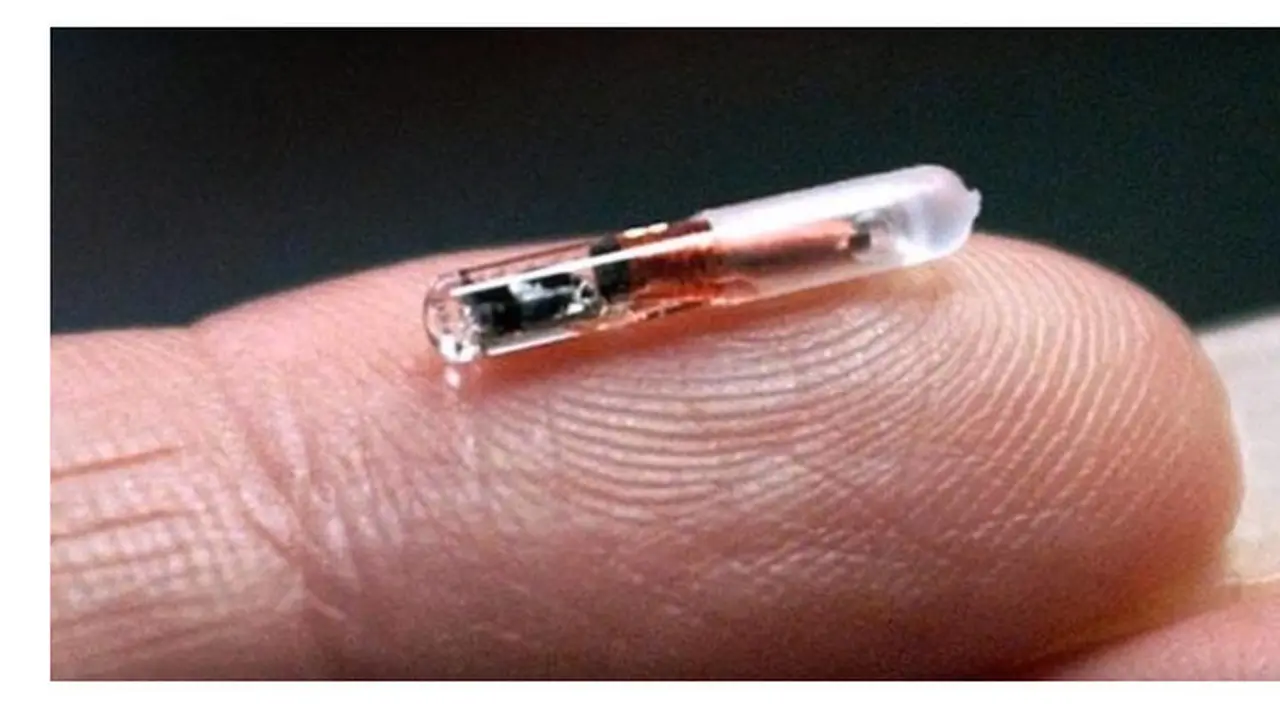 5 Fakta Soal Chip Implan di Manusia yang Mengundang Kontroversi - Tekno ...