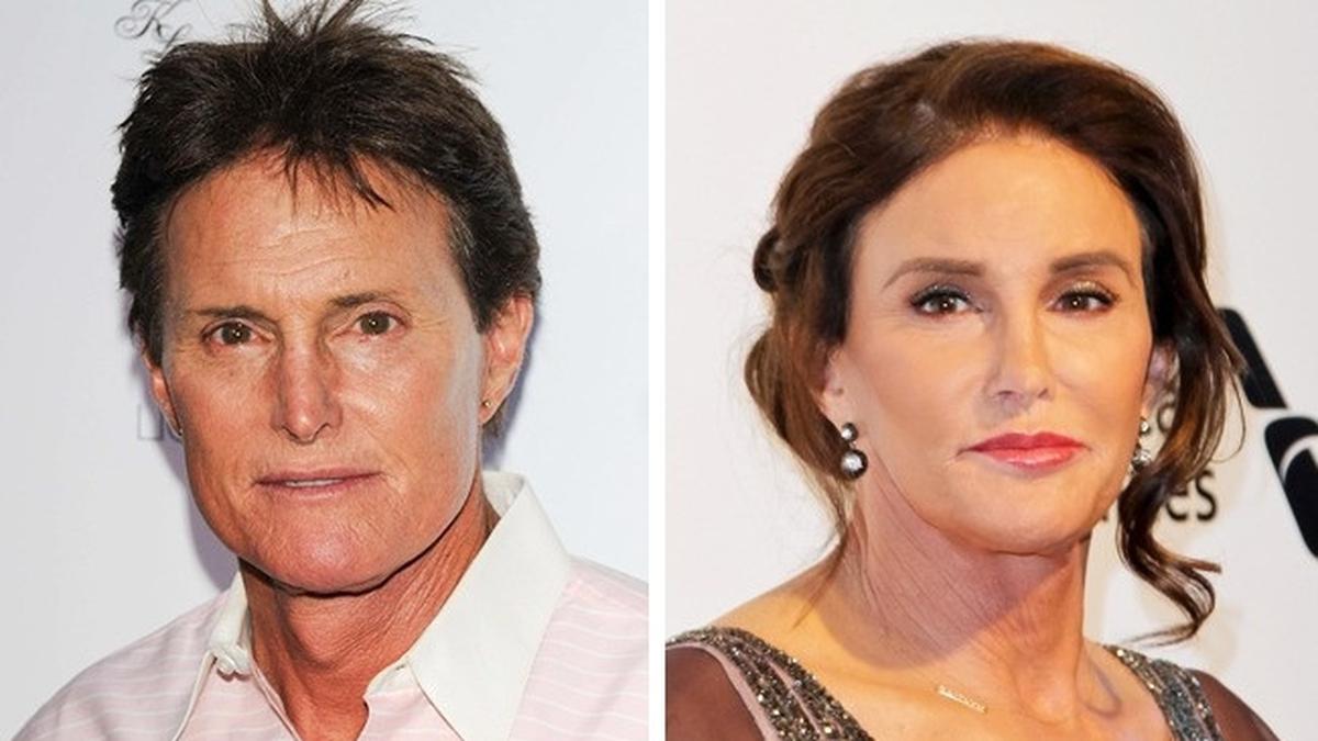 10 Penampilan Artis Hollywood Berubah Drastis Usai Operasi Plastik ...