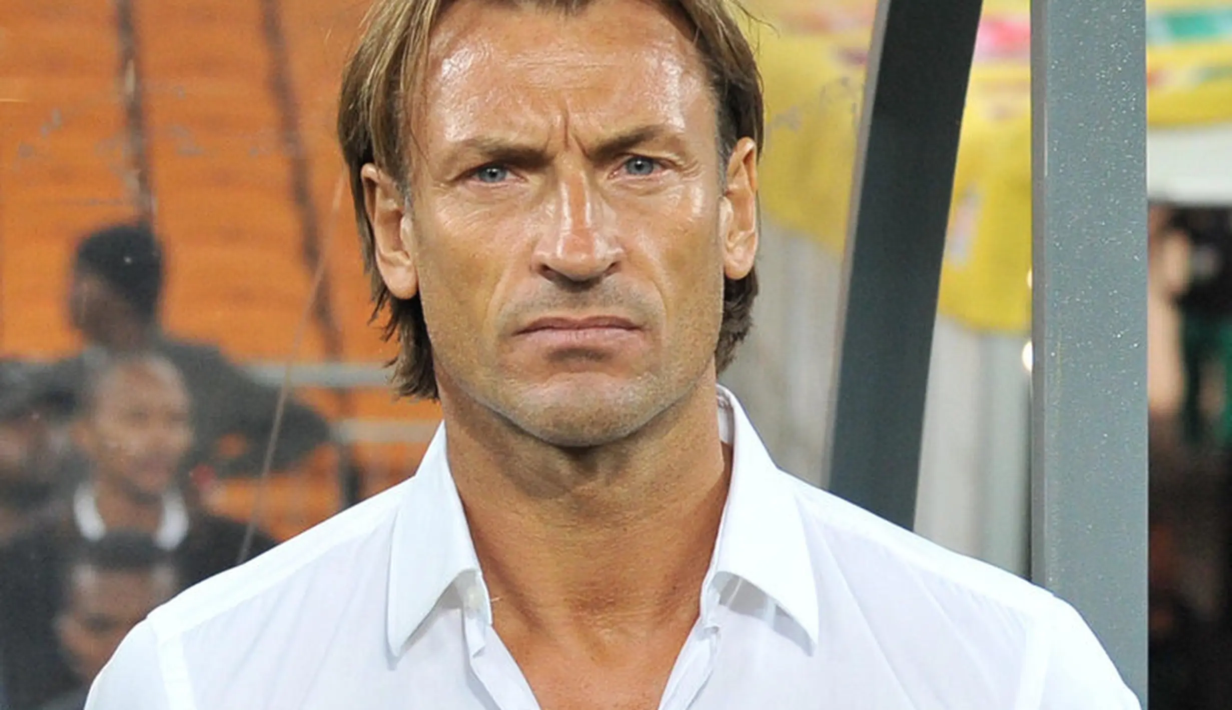 Foto: Mirip Jaime Lannister Game of Thrones, Berikut Potret Herve ...