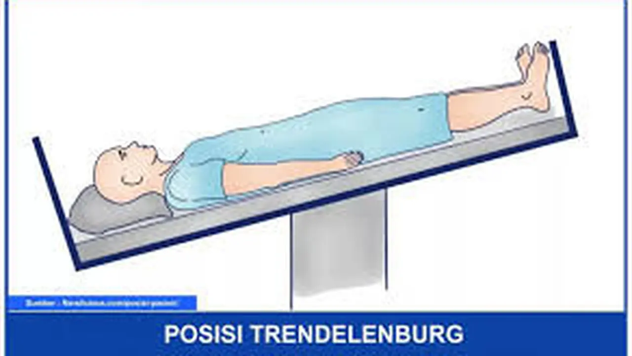 Mengenal Posisi Trendelenburg, Manfaat, dan Langkahnya dalam Dunia ...