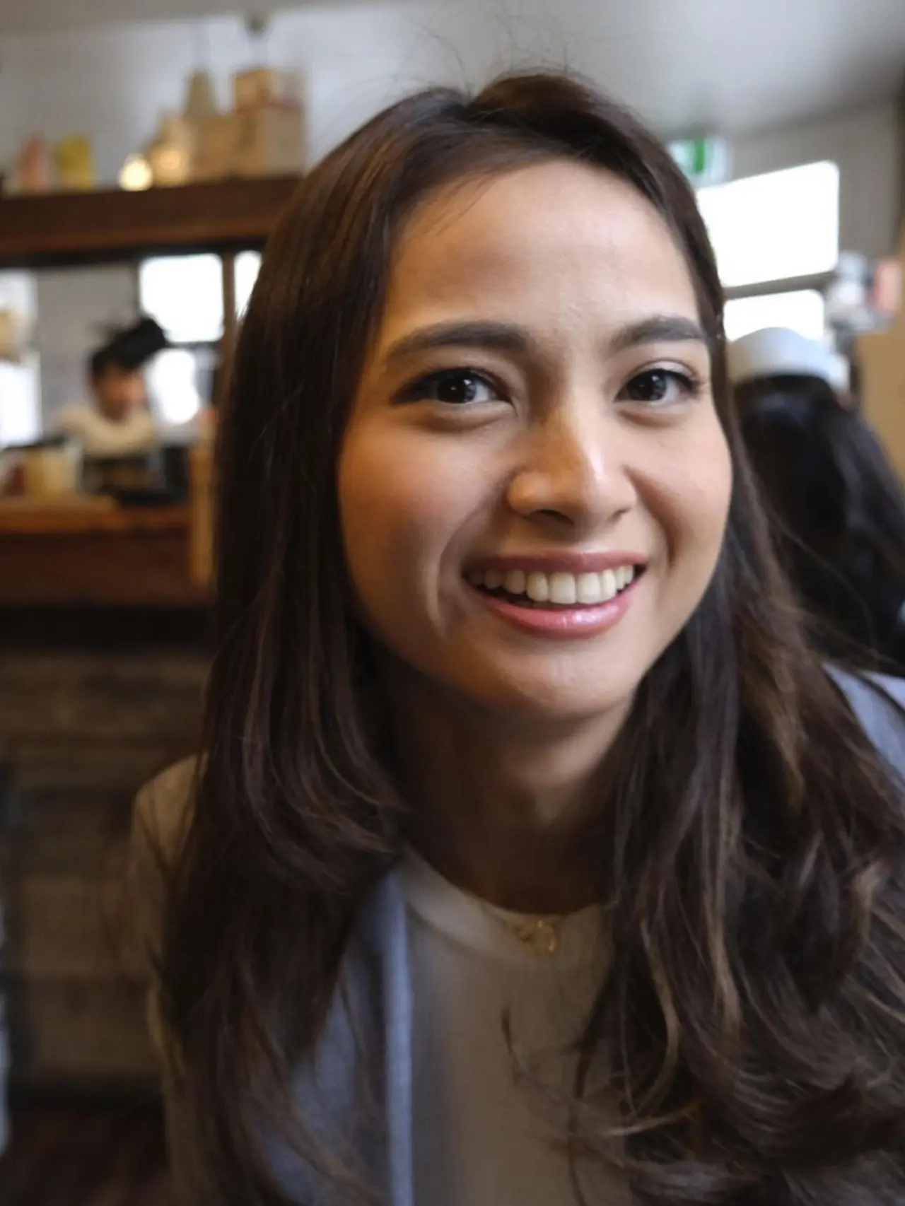 Mengharukan, Kisah Acha Septriasa Hidup dengan Satu Ginjal