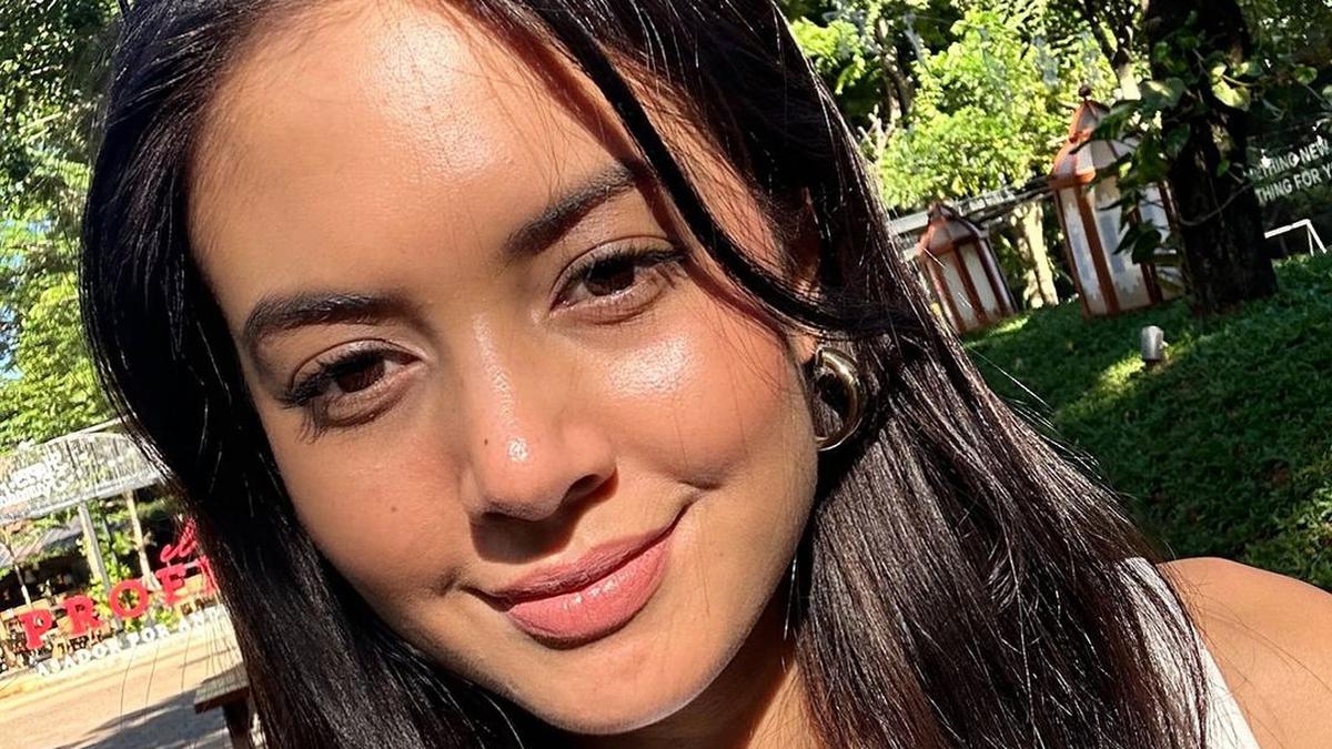 Kisah Aurelie Moeremans Pernah Disebut Dekil hingga Disarankan Suntik ...