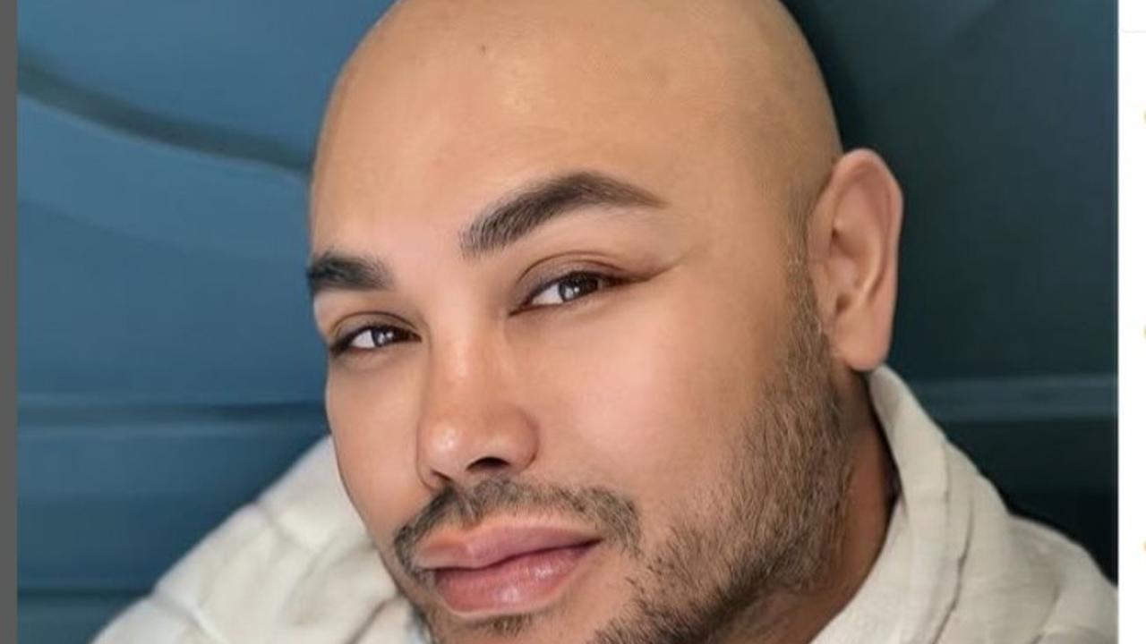 Tuntas Jalankan Ibadah Haji, Ivan Gunawan Kini Tampil dengan Kepala Plontos