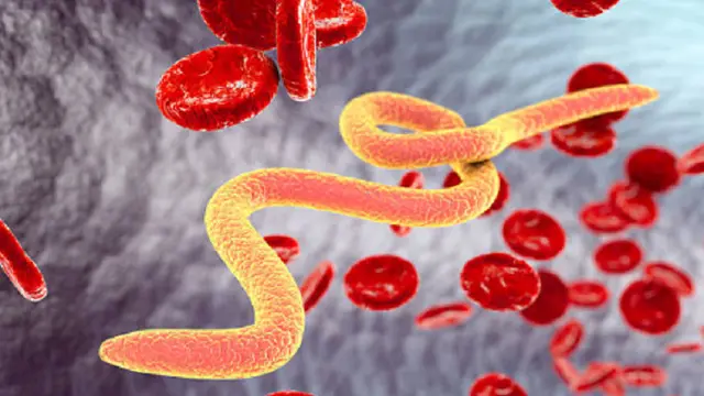 Gejala Cacingan Pada Anak dan Orang Dewasa yang Perlu Diwaspadai ...