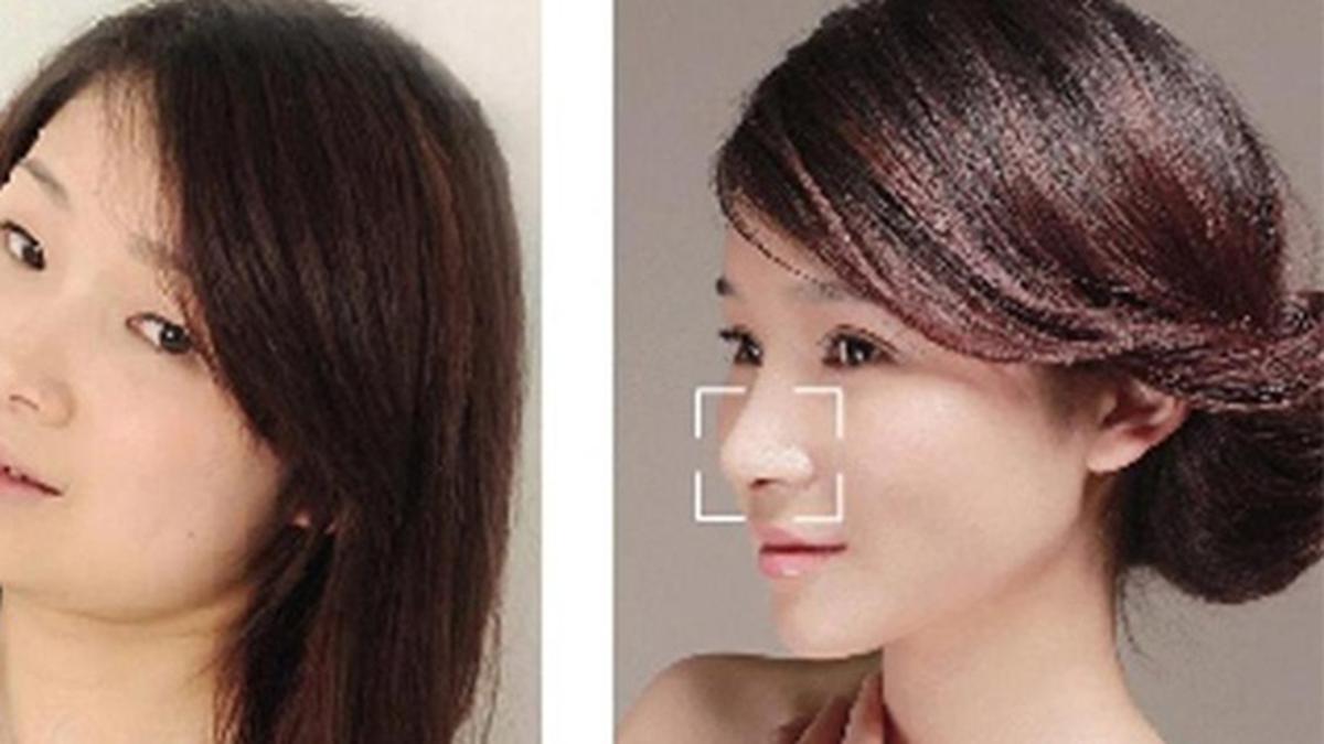 Perubahan Wajah Pasca Operasi Plastik Yang Akan Membuat Anda Kaget ...
