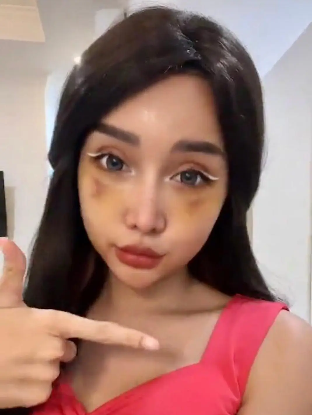8 Potret Wajah Baru Lucinta Luna usai Operasi Plastik, Disebut Mirip ...