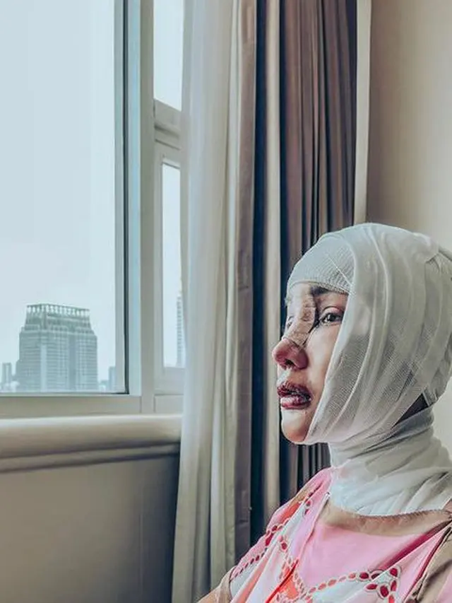 8 Potret Lucinta Luna Operasi Plastik Lagi, Gergaji Rahang dan Potong ...