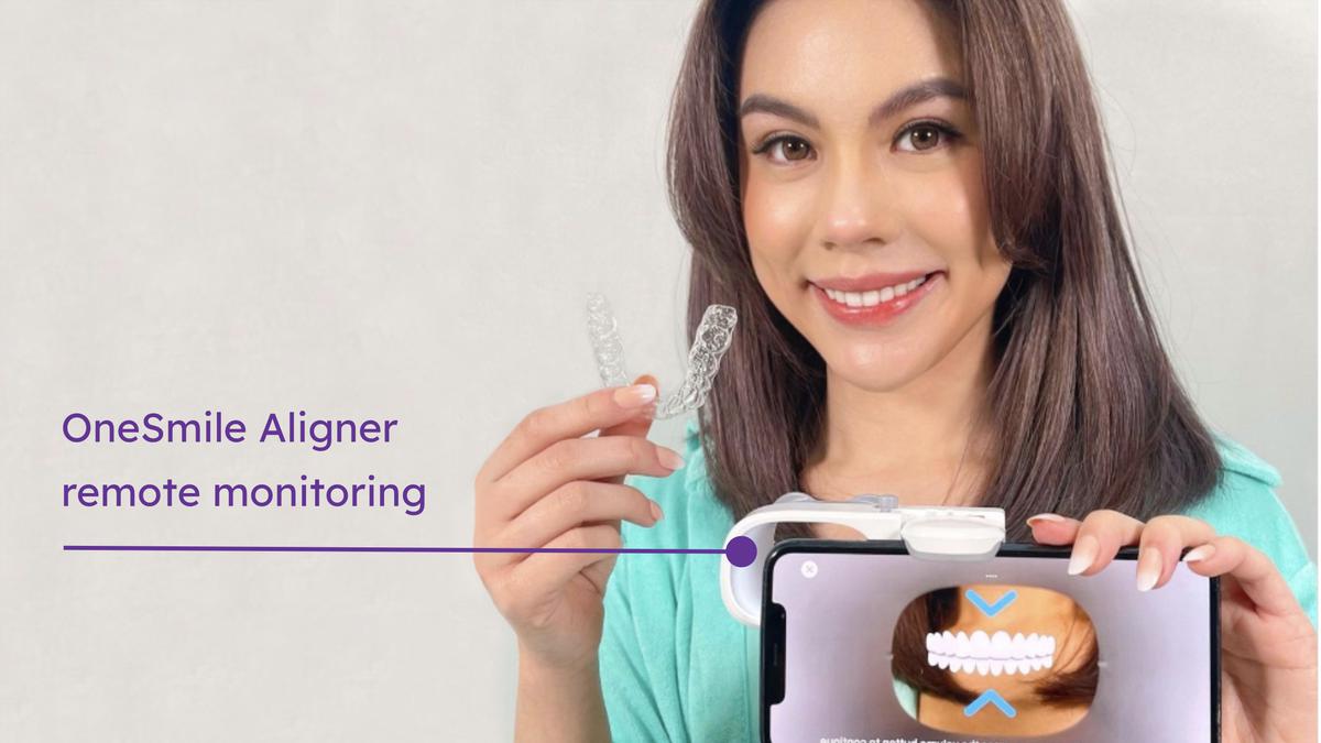 Pengguna Aligner Gigi di Indonesia Kini Makin Dimanjakan dengan Pelayanan OneSmile - ShowBiz ...