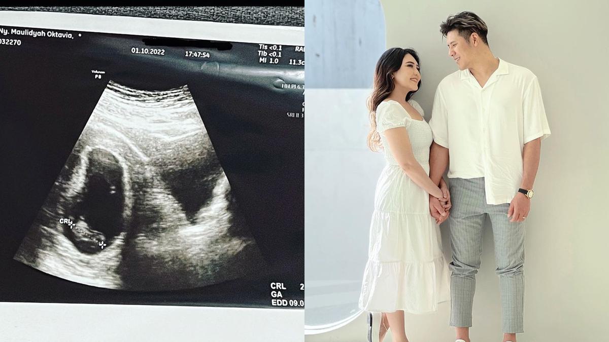 Jantung Janin Via Vallen Tak Berdetak di Usia 8 Minggu, Ini 7 Potretnya Bareng Suami - Hot ...