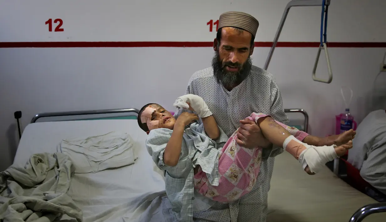 FOTO: Potret Menyedihkan Anak-Anak Korban Perang Afghanistan - Foto ...