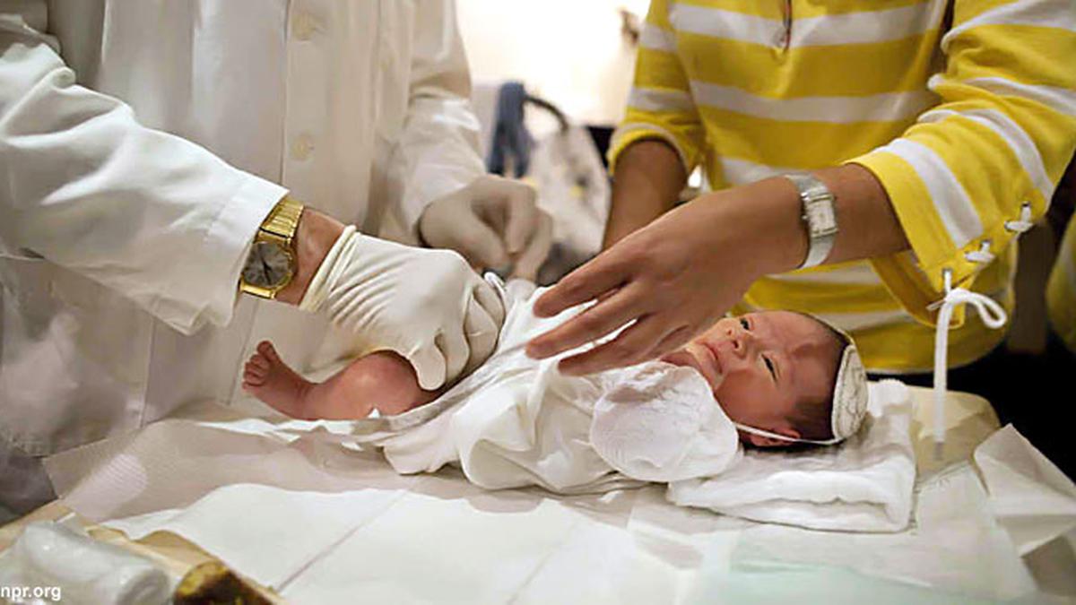 Sunatlah Bayi di Saat Usia 10-60 Hari, Kenapa? - Health Liputan6.com