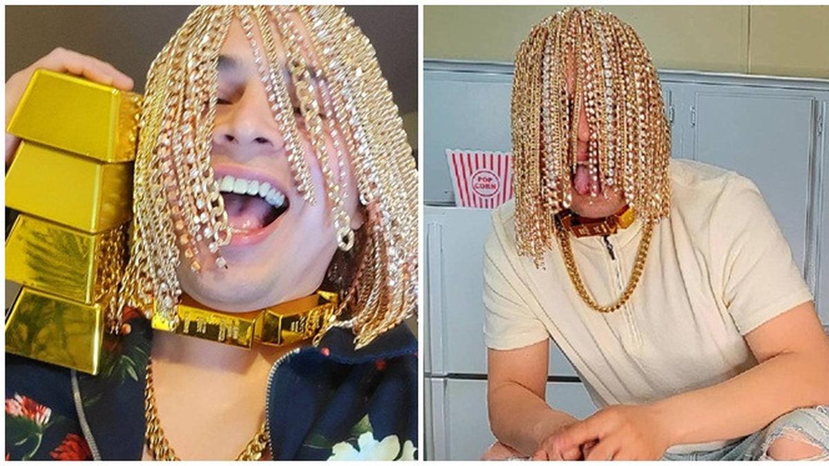 Rapper Ini Pasang Implan Rantai Emas Sebagai Pengganti Rambut, Curi ...