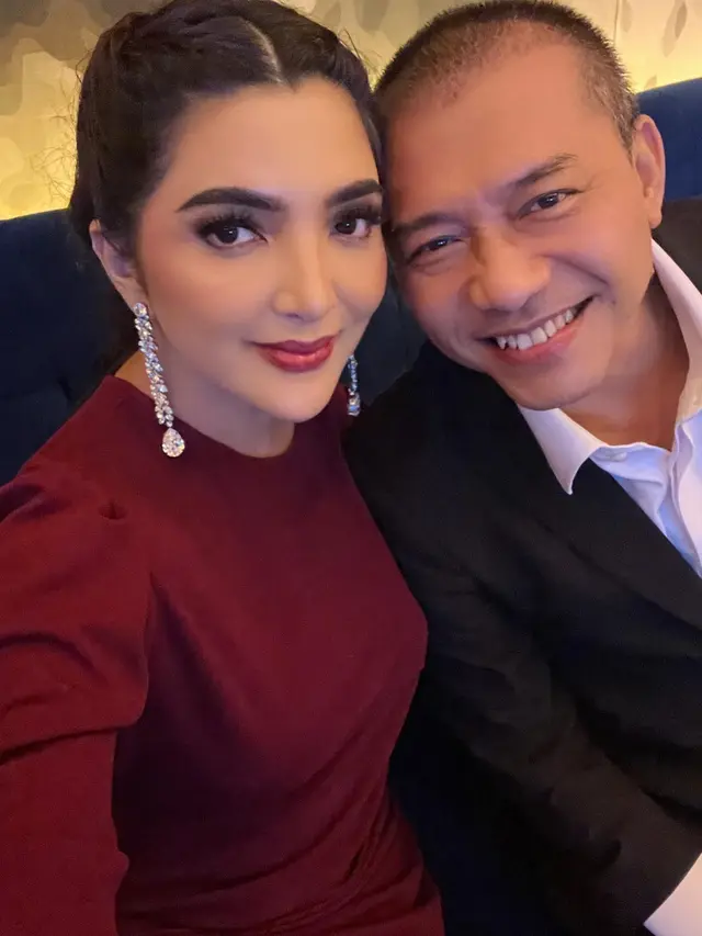 7 Potret Rambut Anang Hermansyah yang Mulai Tumbuh usai Transplantasi ...