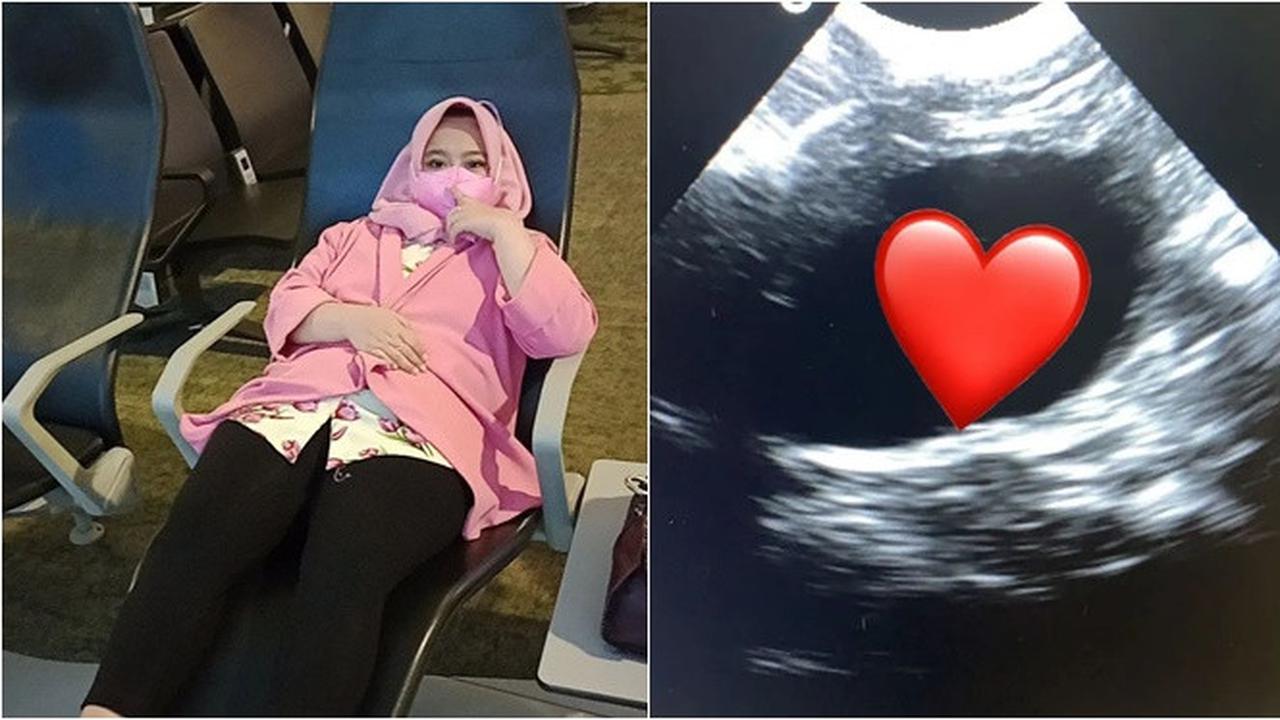 Kekeyi Unggah Foto Hasil USG, Ini 6 Potret Terbarunya
