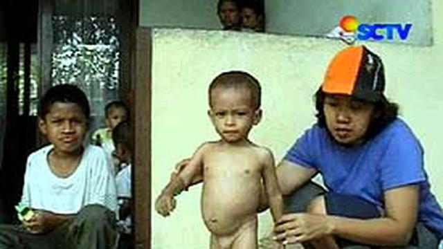 Busung Lapar di Kabupaten Sikka Belum Enyah - News Liputan6.com