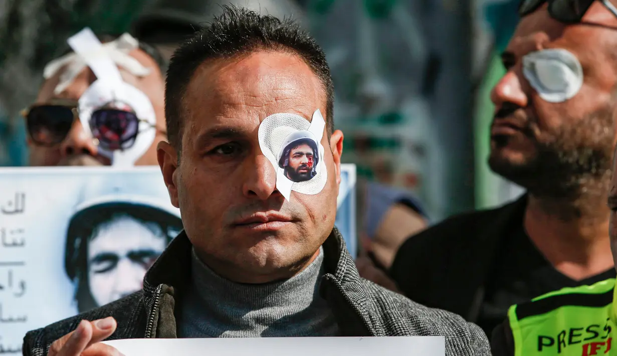 FOTO: Israel Lukai Wartawan Foto, Jurnalis Palestina Gelar Aksi ...