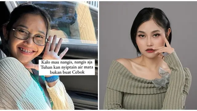 6 Potret Riyuka Bunga Sebelum dan Sesudah Oplas Hidung, Dulu Dipanggil ...