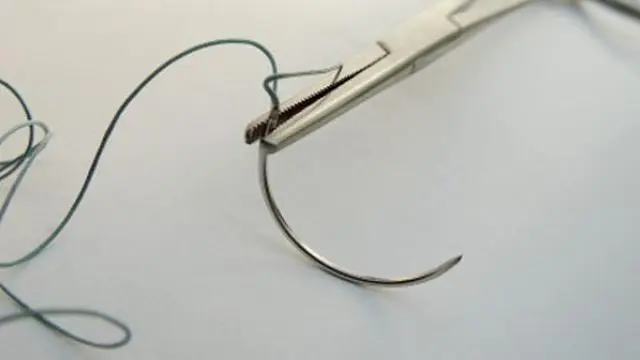 4 Jenis Benang Jahit Luka yang Sering Digunakan, Kenali Bahan dan Fungsinya - Hot Liputan6.com