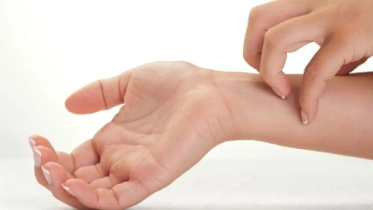 14 Penyebab Bercak Merah Gatal pada Kulit dan Cara Mengatasinya - Hot ...