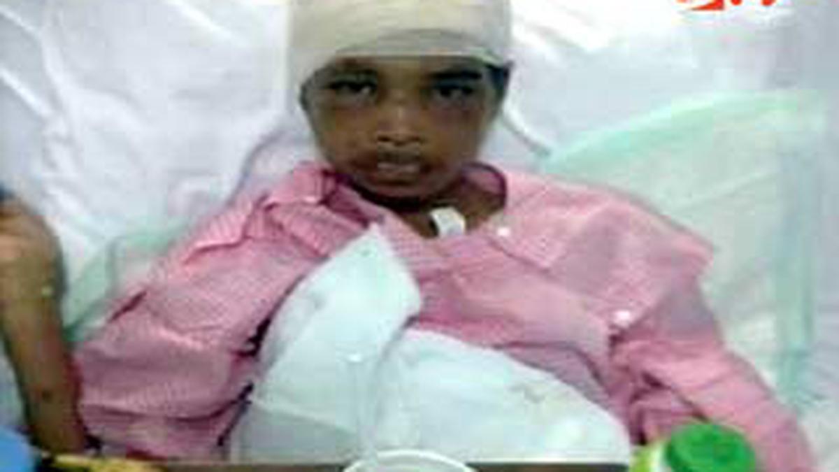 Usai Operasi, Sumiati Tak Boleh Dijenguk - News Liputan6.com