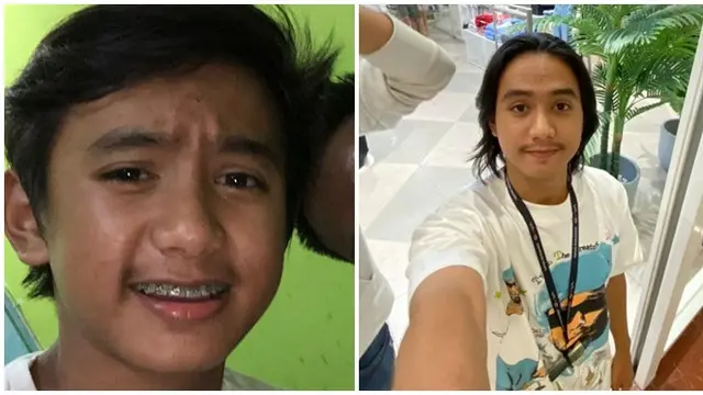 6 Potret Dulu Vs Kini Bowo Alpenliebe, Pernah Viral Disebut Mirip Iqbaal Ramadhan - Hot Liputan6.com