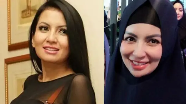 Filler Bibir Berujung Ketagihan? Intip 10 Transformasi Artis Ini ...