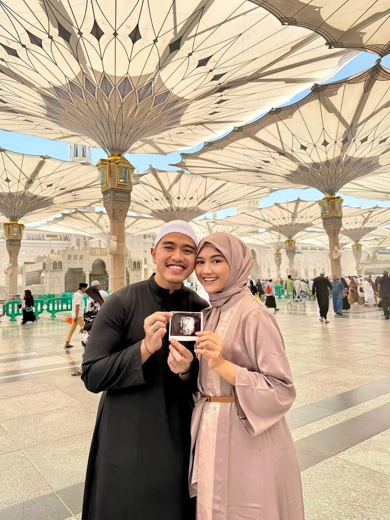 Kaesang Pangarep Umumkan Erina Gudono Hamil Trimester 2, Pamer Foto Hasil USG di Dekat Kabah ...