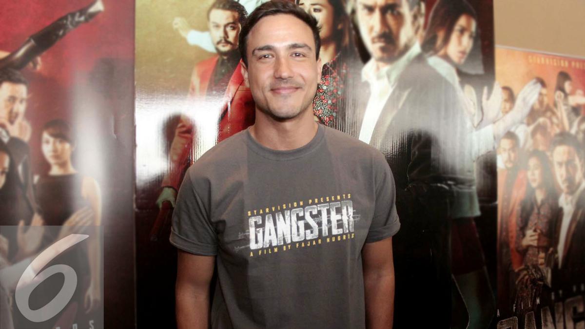 Kecelakaan, Wajah Hamish Daud Penuh dengan Besi - ShowBiz Liputan6.com