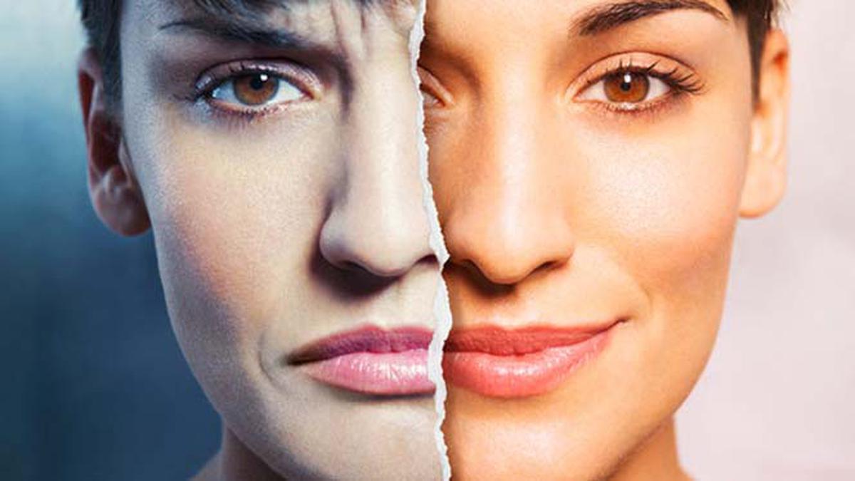 Kenapa Penderita Bipolar Tak Cepat Terdeteksi? - Health Liputan6.com